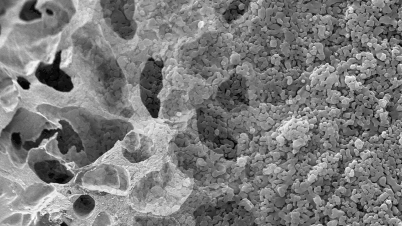 Bone Substitutes - Advanced Medical Solutions